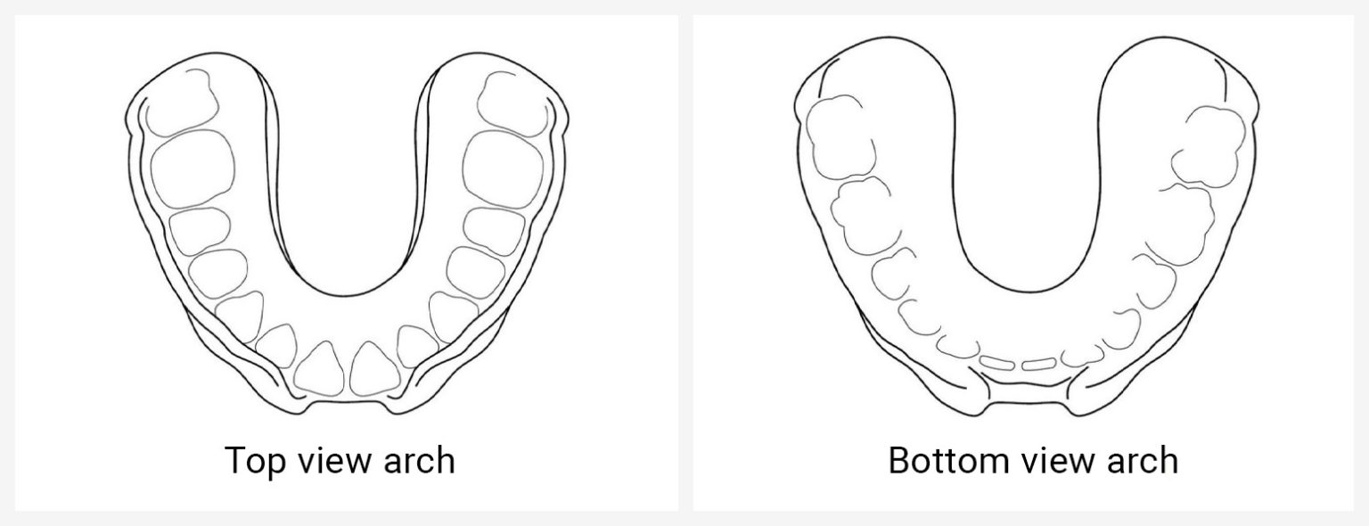 AM Aligner Prevents Bite Change and Tooth Movement | New West