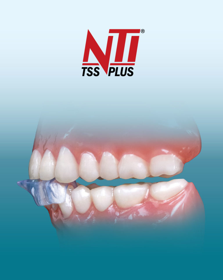 Which Bite Splint Should You Prescribe for Patients? | New West