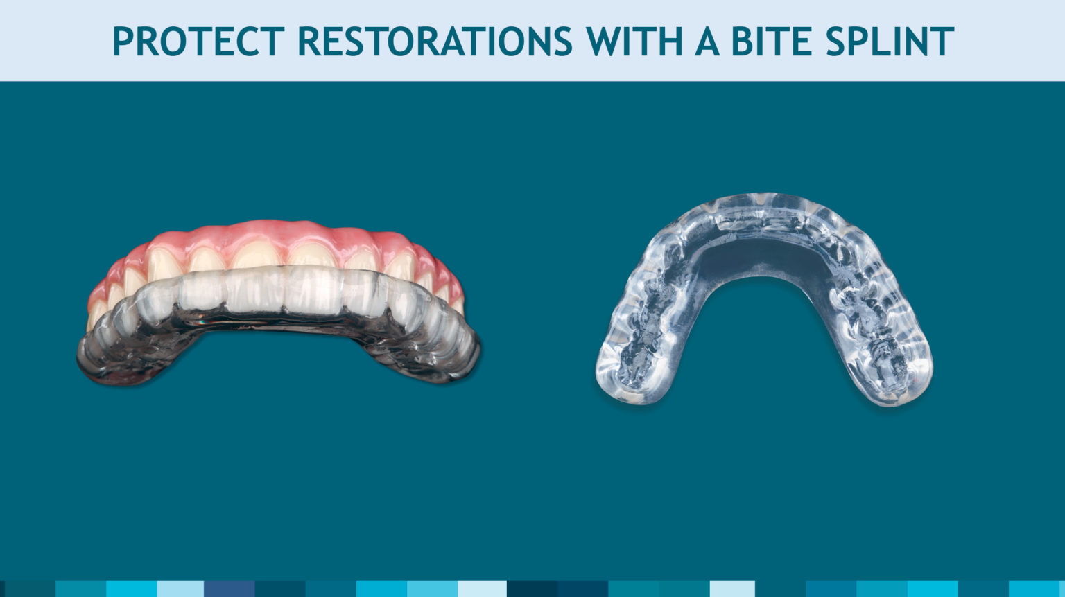 Complete Restorative Solutions by Prescribing Bite Splints