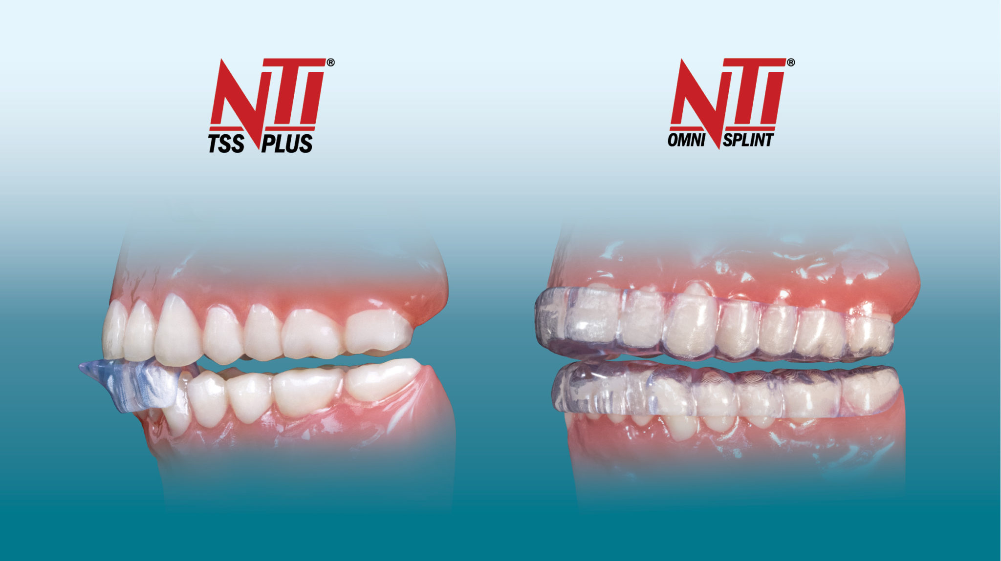 Complete Restorative Solutions by Prescribing Bite Splints