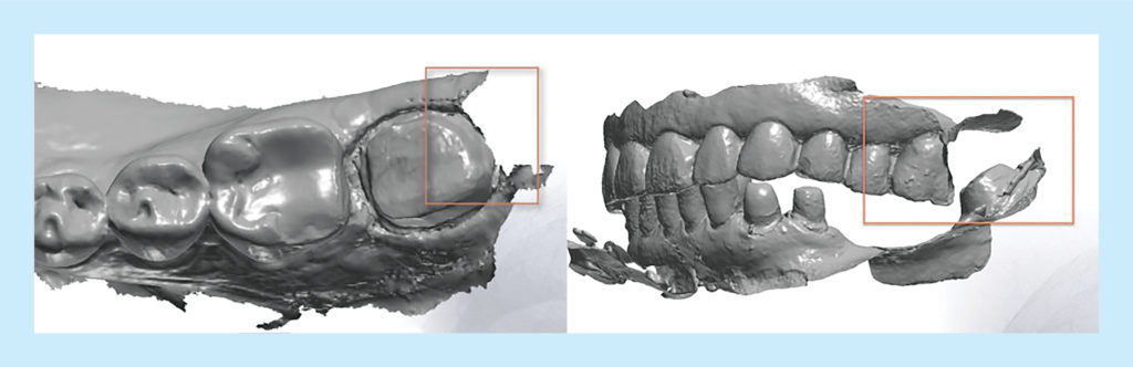 Intraoral Scanning: Become an Intraoral Scanning Expert | New West