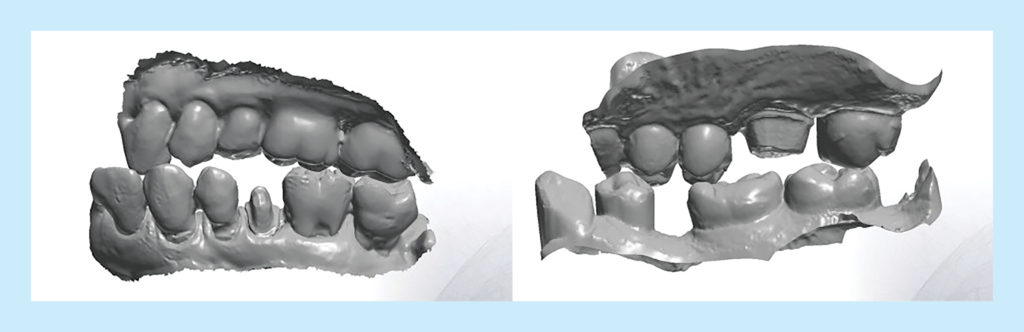 Intraoral Scanning: Become an Intraoral Scanning Expert | New West