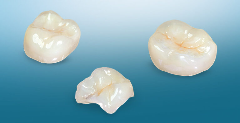 Dental Lab Services at New West | Your Full-Service Dental Implant Lab